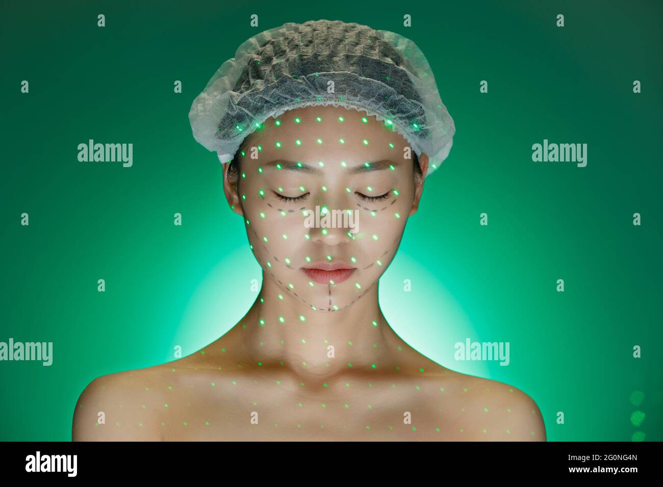 Laser scan skin hi-res stock photography and images - Alamy