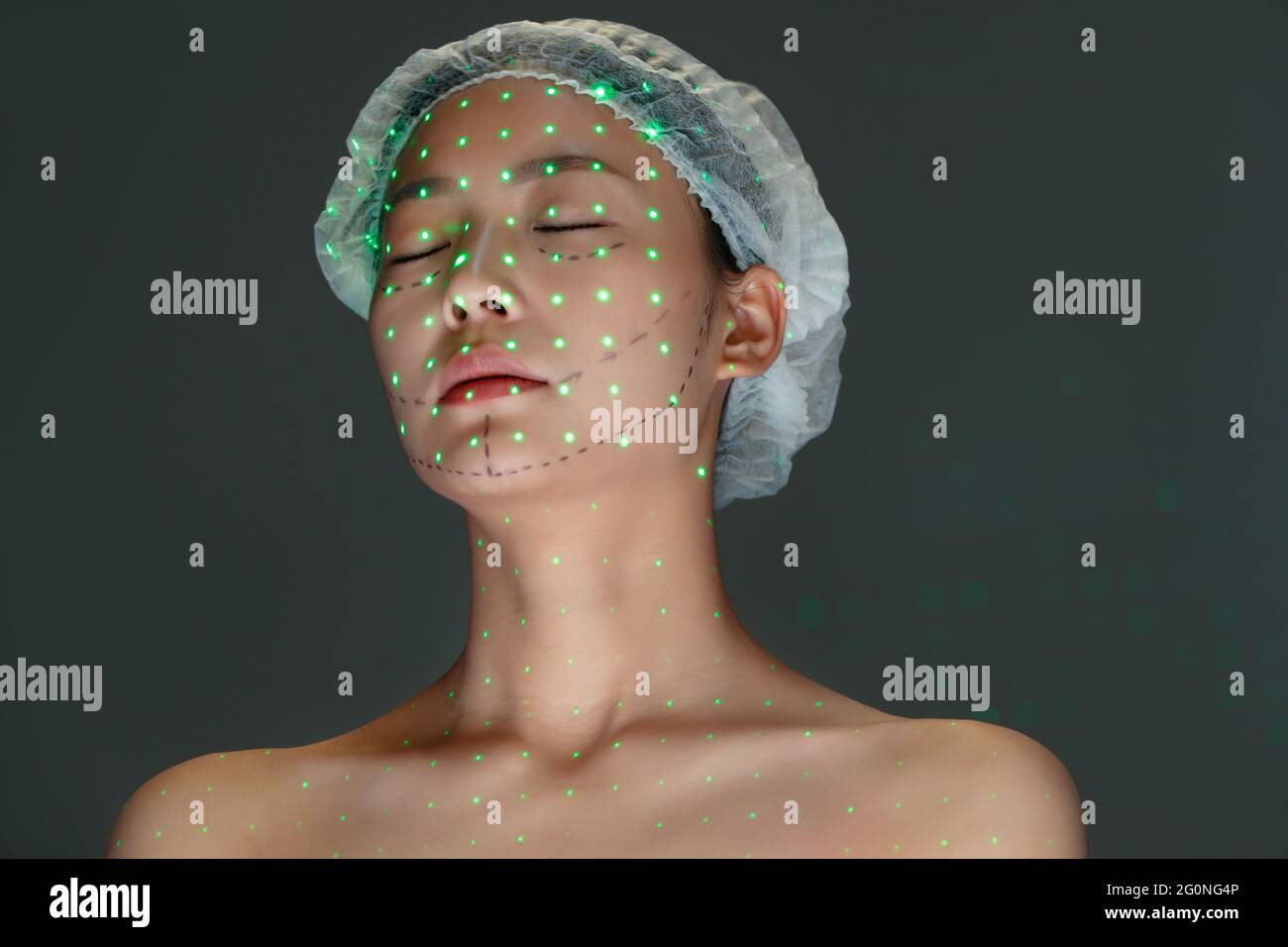 Young woman do laser cosmetic Stock Photo - Alamy