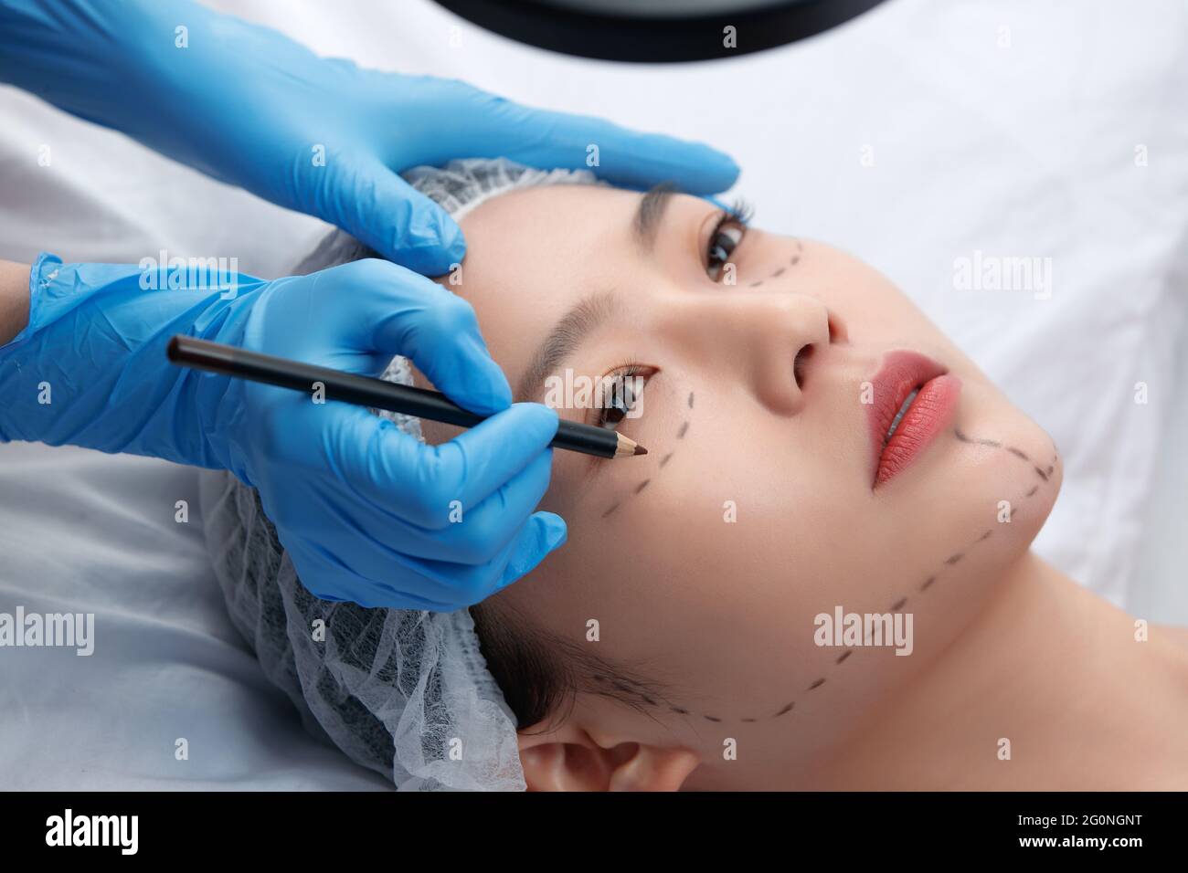 Dotted Lines Plastic Surgery High Resolution Stock Photography and ...
