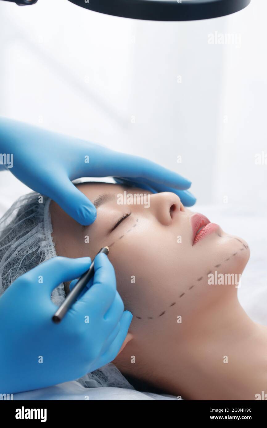 Plastic surgery lines hi-res stock photography and images - Alamy