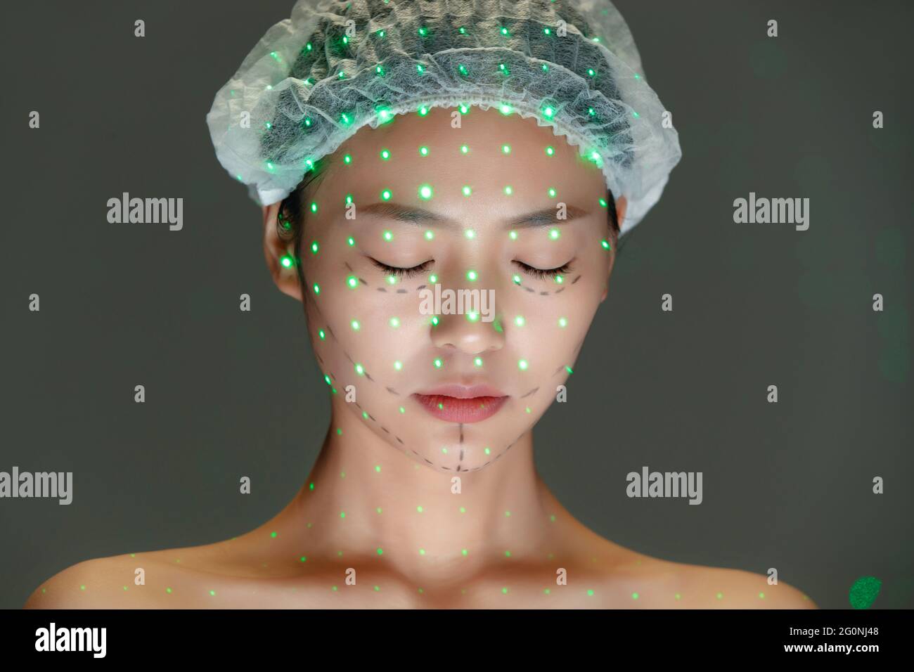 Laser scan skin hi-res stock photography and images - Alamy