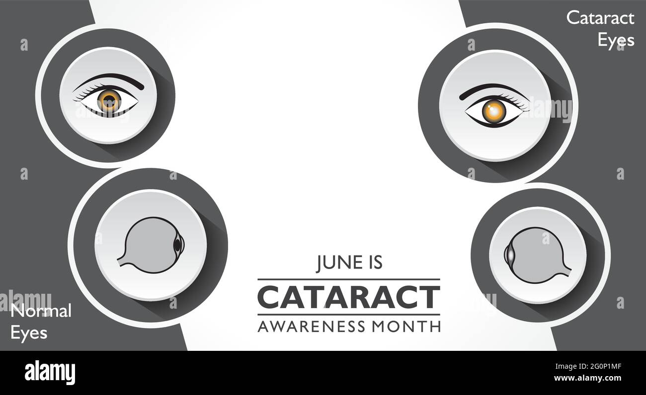 Vector illustration of Cataract Awareness Month observed in June, It is ...