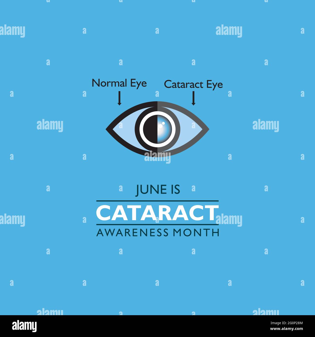 Vector illustration of Cataract Awareness Month observed in June, It is ...