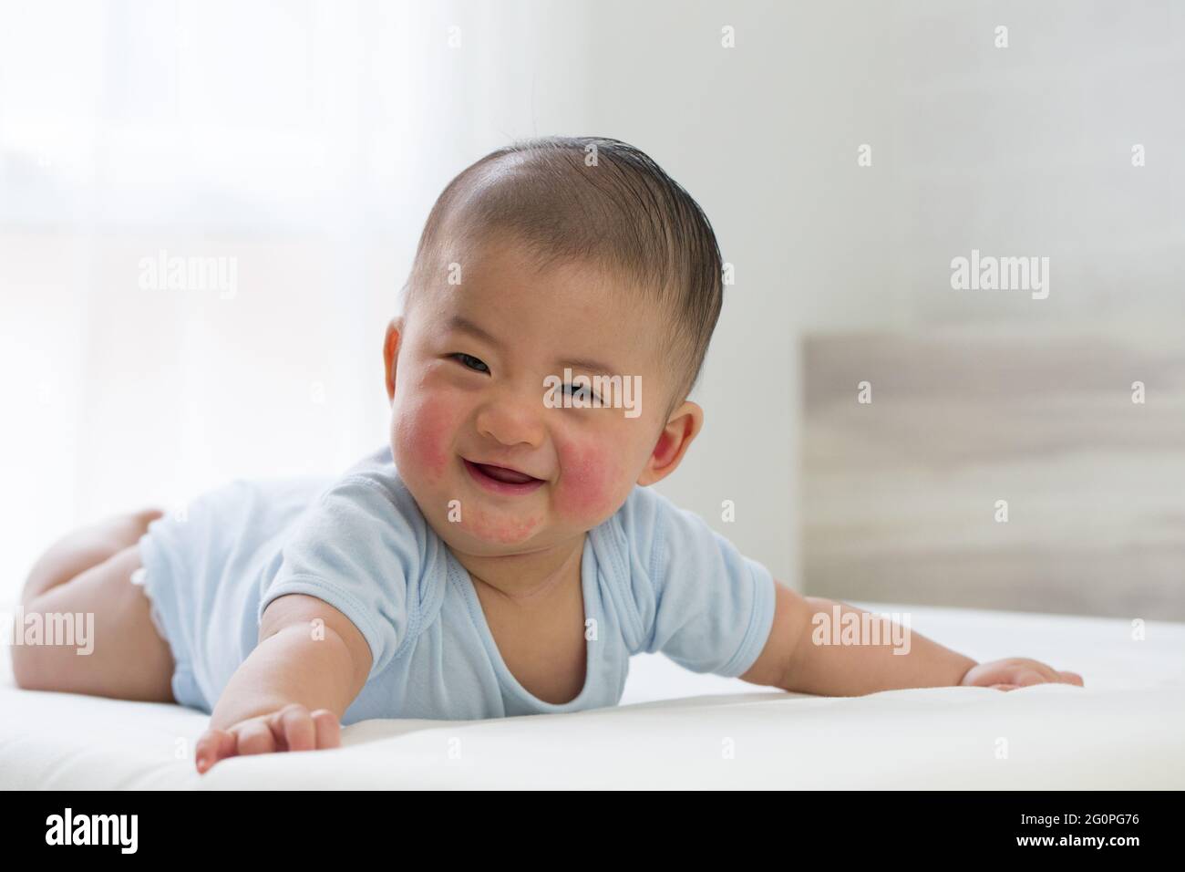 Childhood rashes, skin conditions and infections concept Stock Photo ...