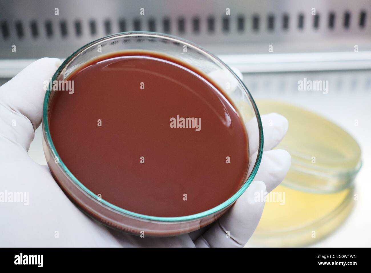 Blood agar hi-res stock photography and images - Alamy