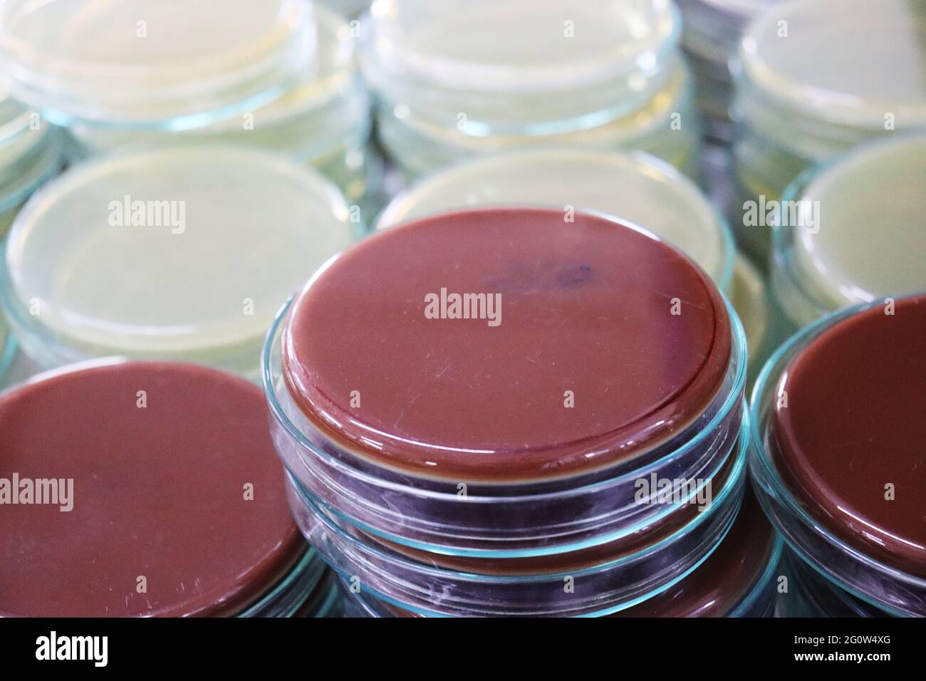 Solid medium bacteria hi-res stock photography and images - Alamy