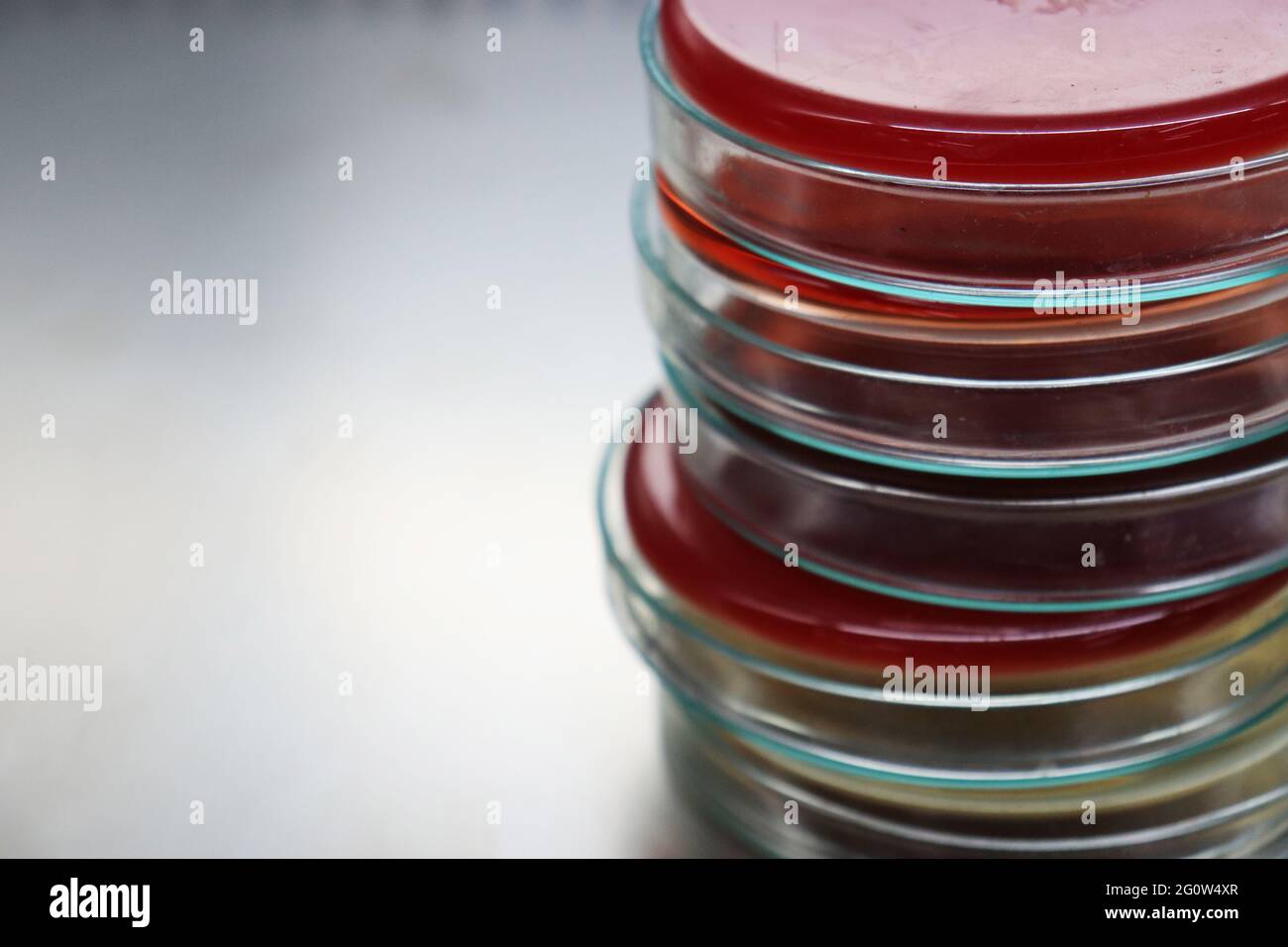 Solid medium bacteria hi-res stock photography and images - Alamy