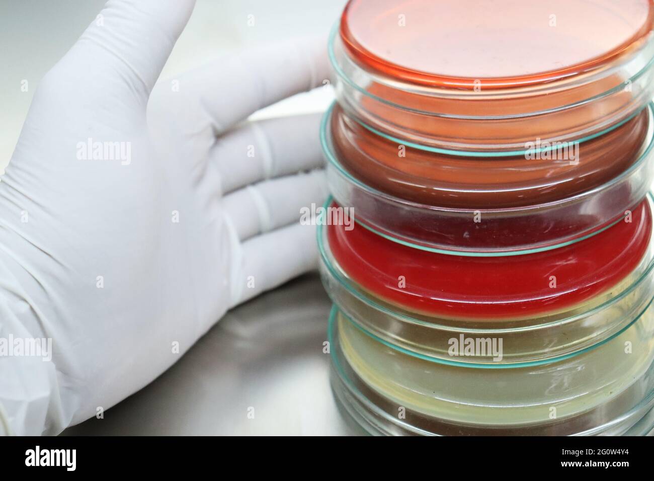 A growth medium or culture medium is a solid, liquid, or semi-solid ...