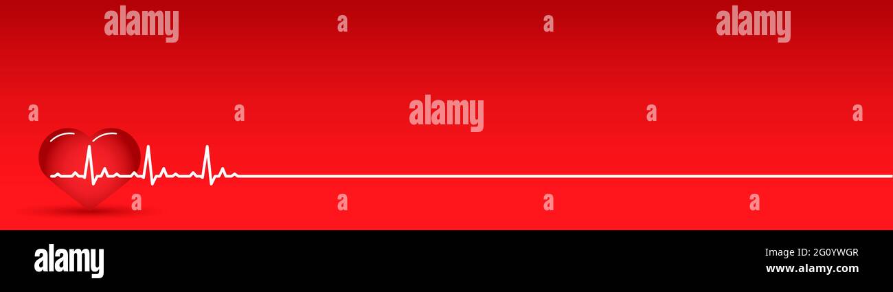 Normal Heart Rate Line