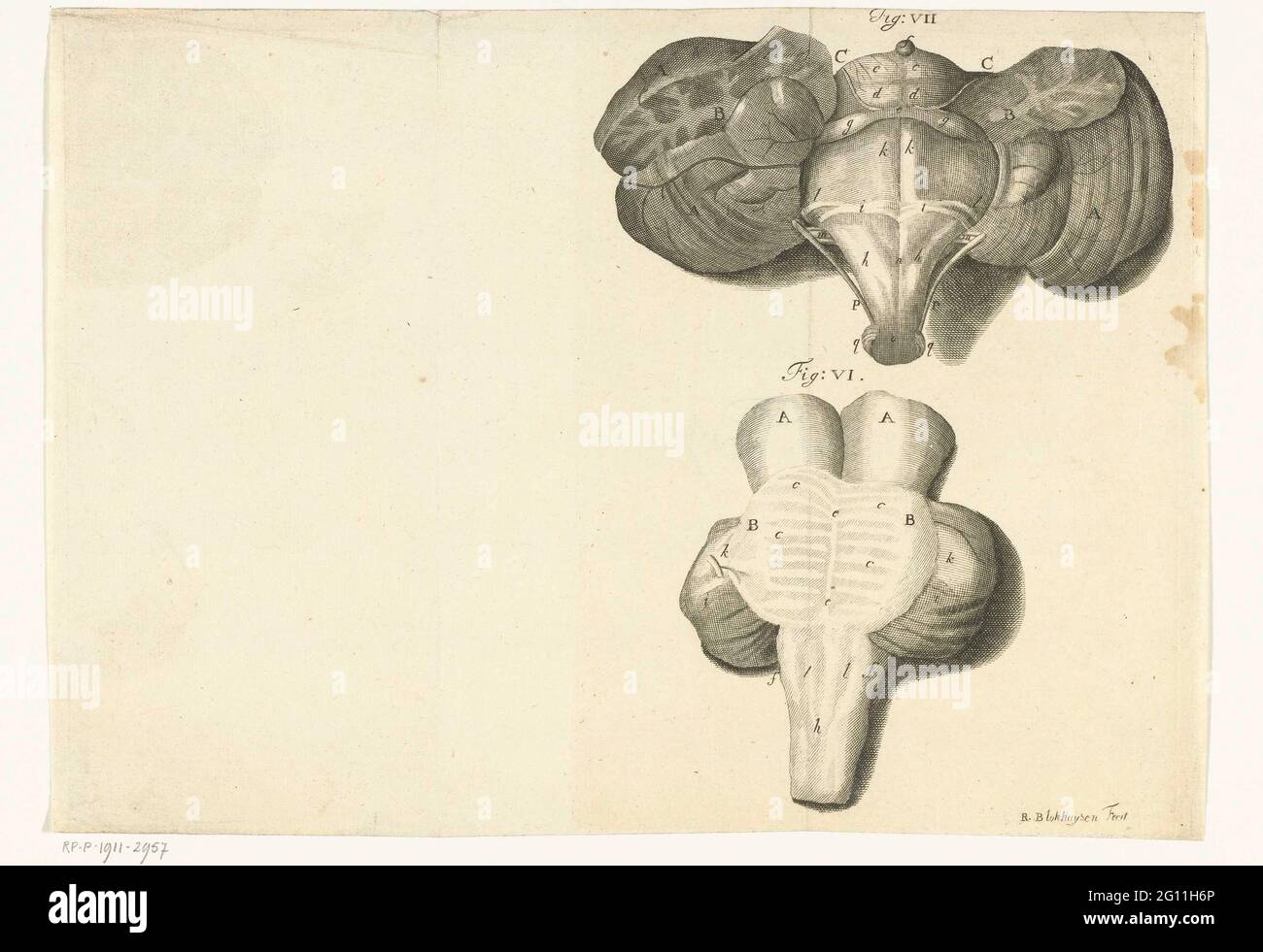 Anatomical representation of a body from the human body. Anatomical ...