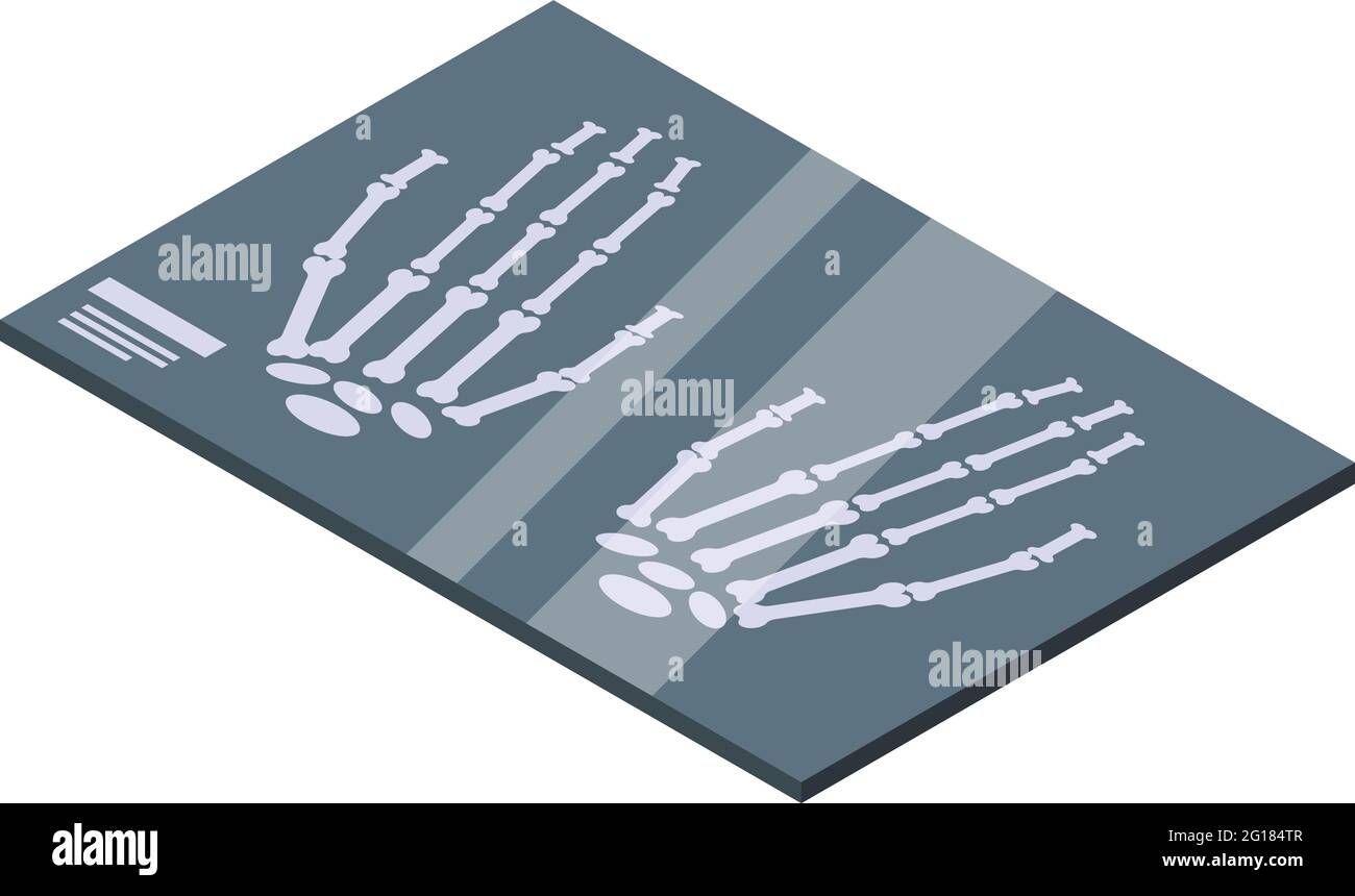 Arthritis x ray image icon. Isometric of Arthritis x ray image vector ...