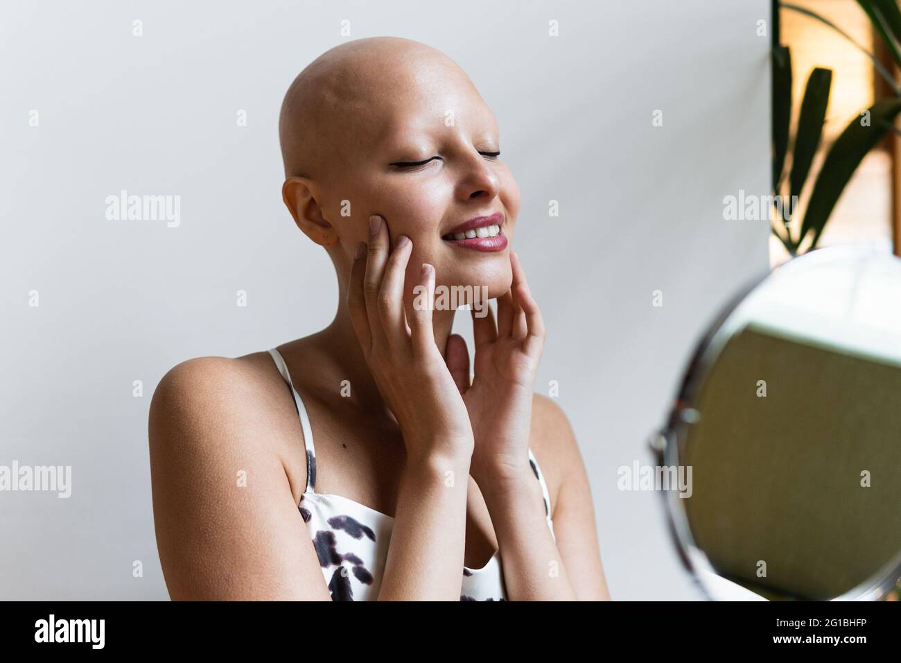 Happy young hairless female with alopecia disease in stylish outfit and ...