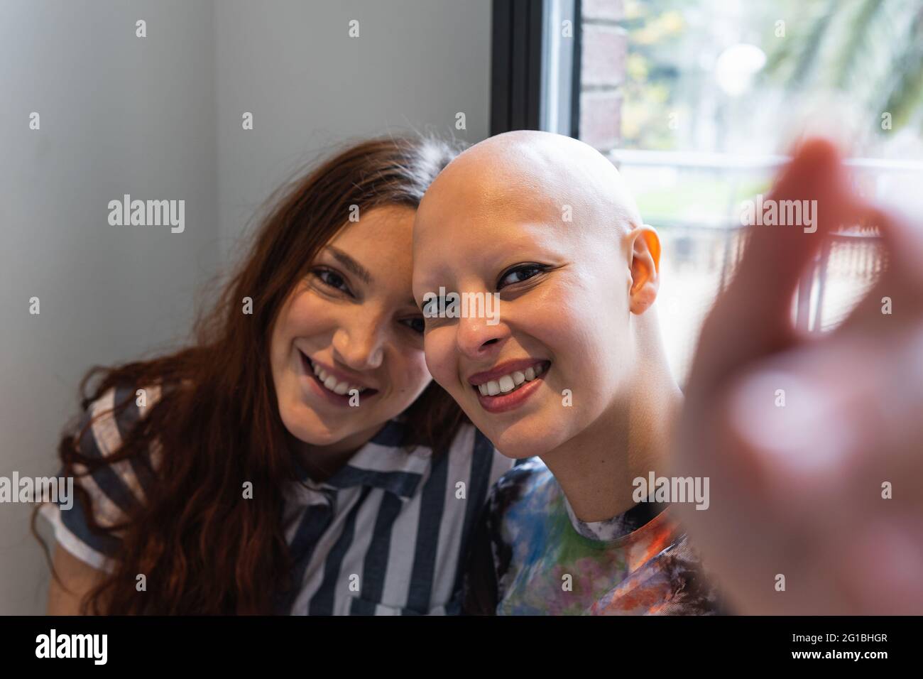 Alopecia women hi-res stock photography and images - Alamy