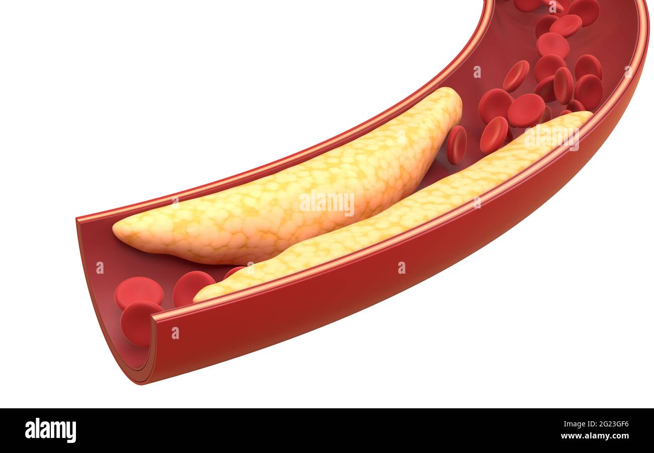 Fat and red blood cells in blood vessels, 3d rendering. Computer ...
