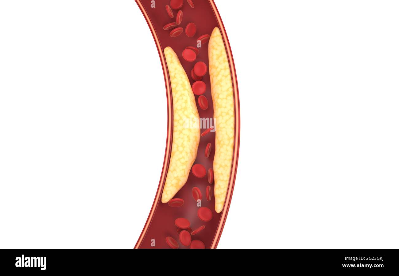 Fat and red blood cells in blood vessels, 3d rendering. Computer ...