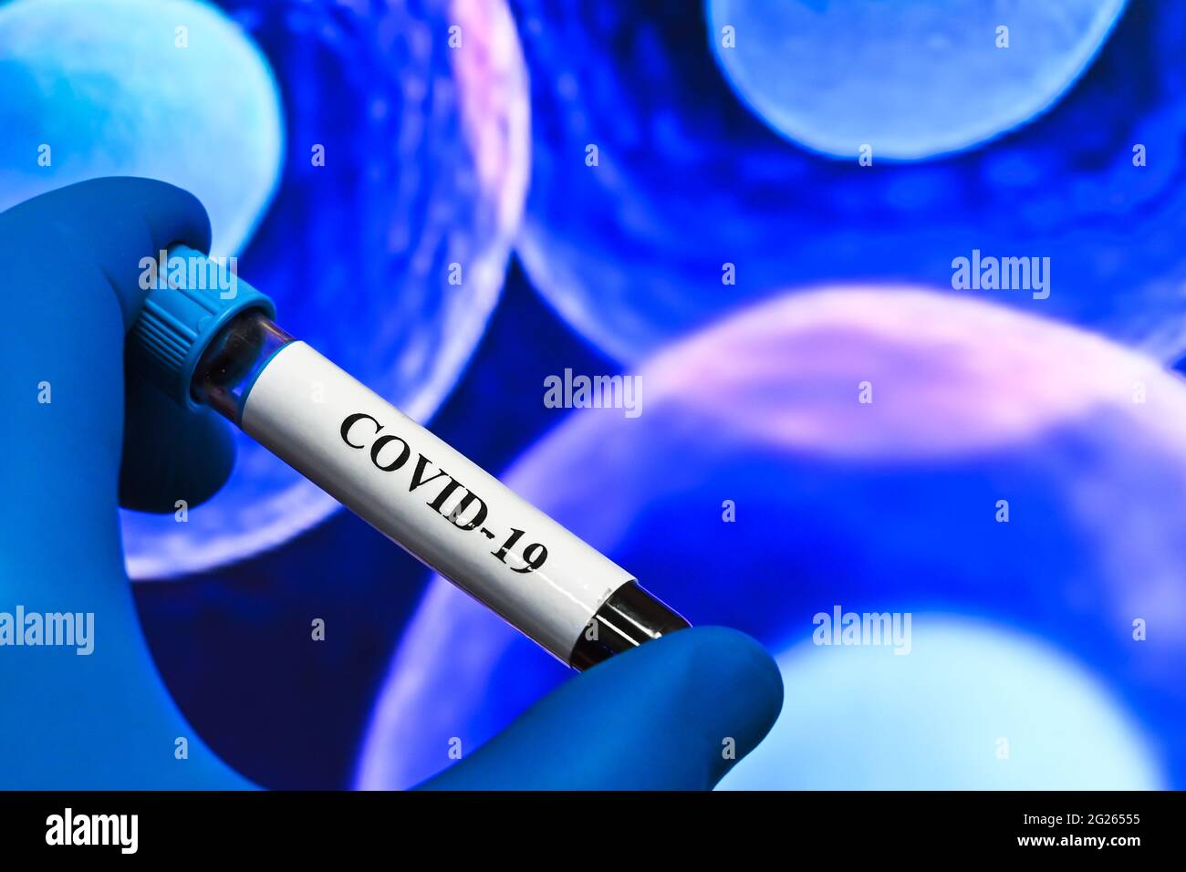 COVID-19 research. Testing a biological sample for coronavirus Stock ...