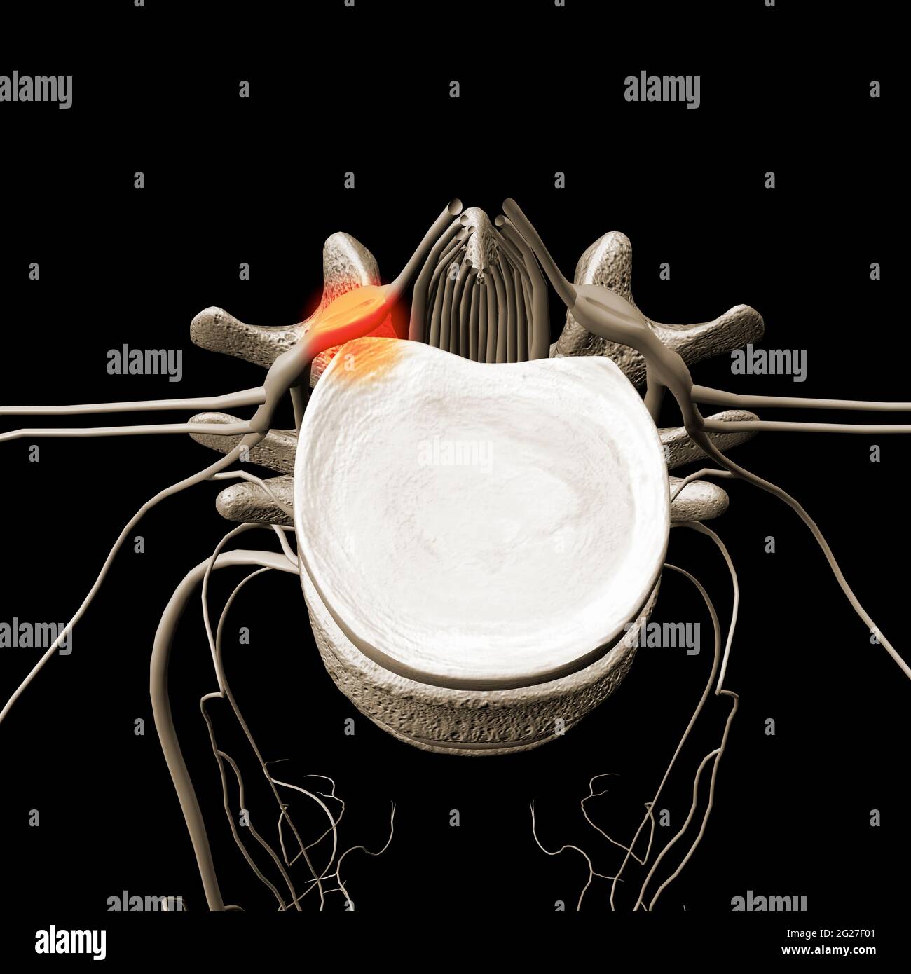 Spinal nerve roots hi-res stock photography and images - Alamy
