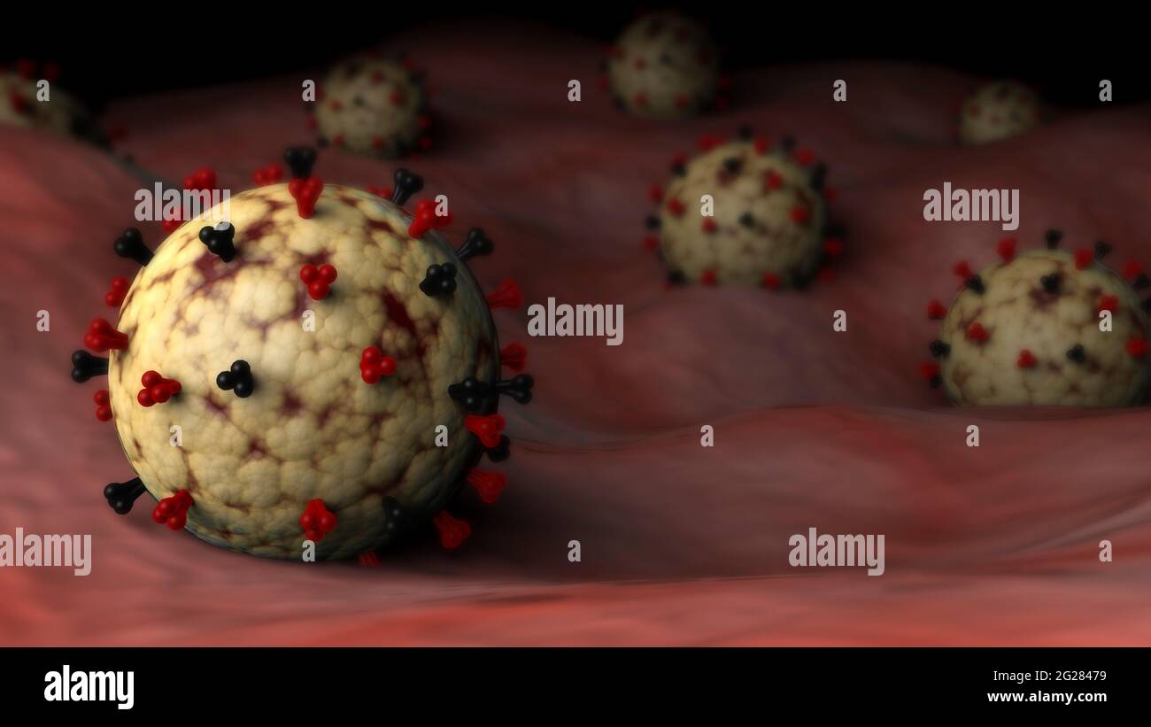 Biomedical illustration of eastern equine encephalitis inside the brain ...
