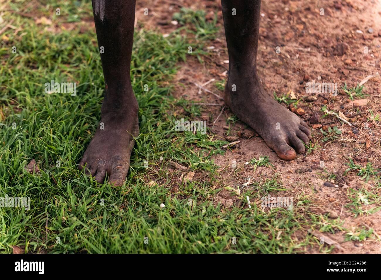 Mud covered feet hi-res stock photography and images - Alamy