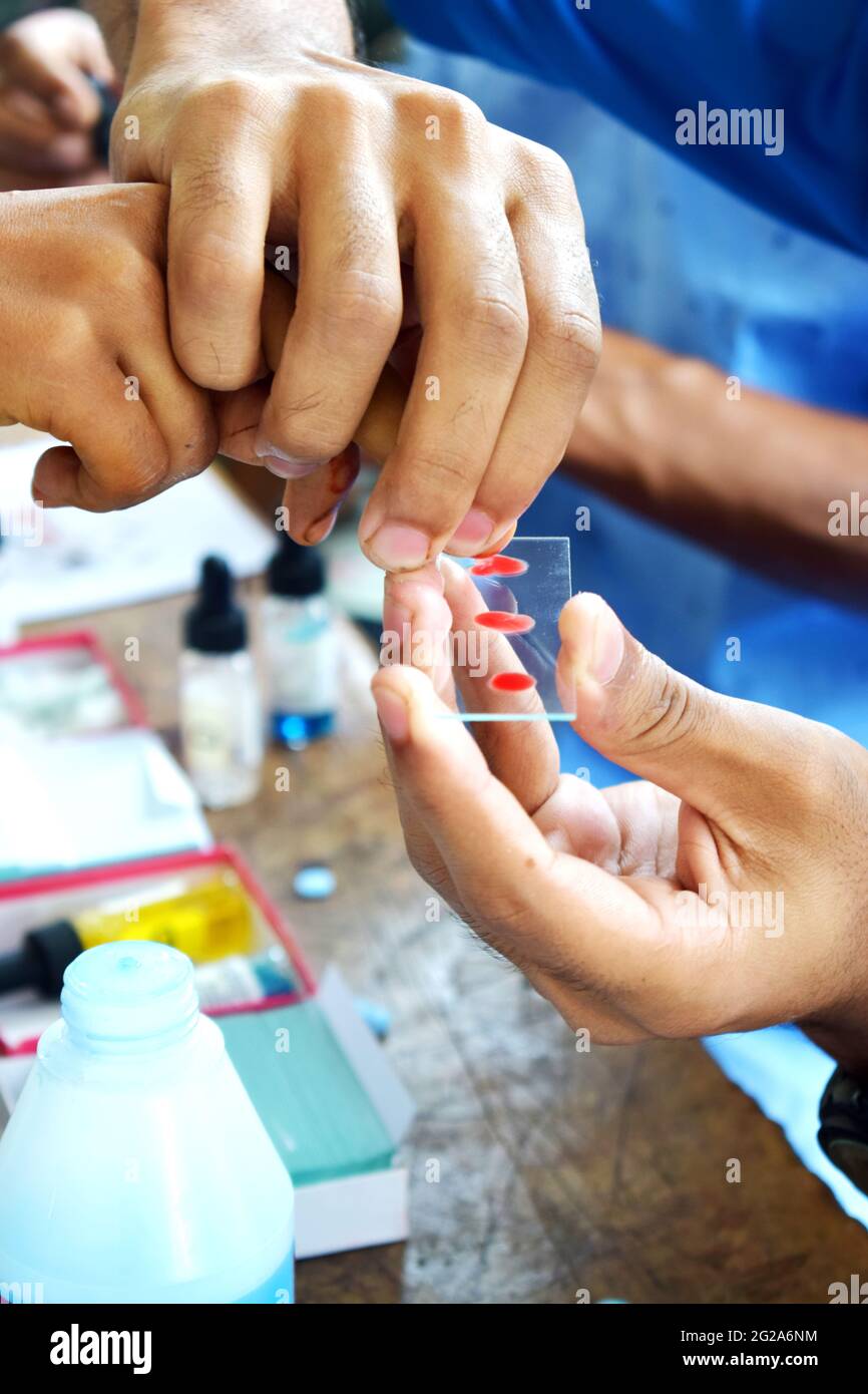 Rh Factor High Resolution Stock Photography and Images - Alamy