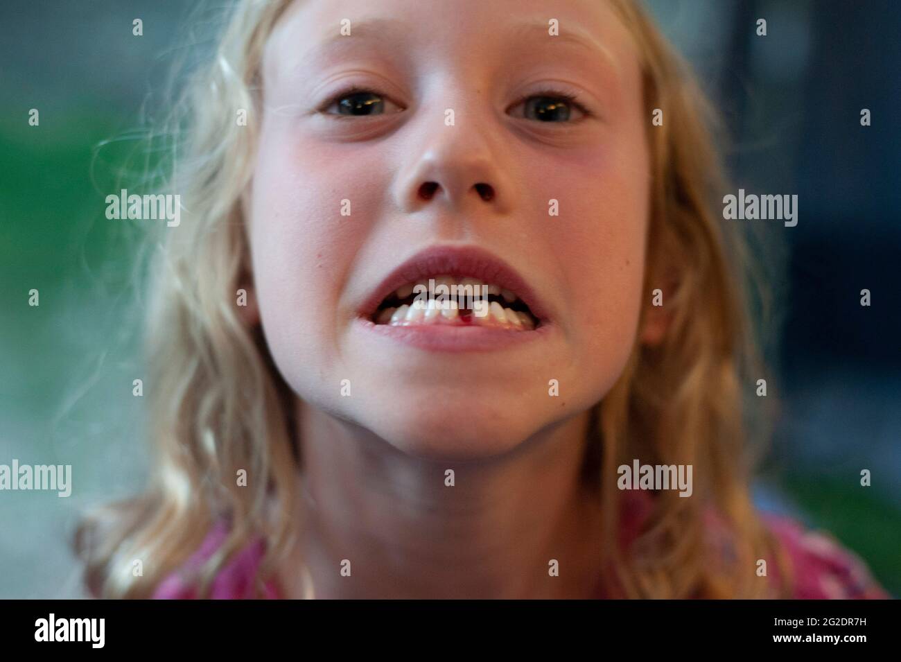 A young girl proudly shows off her mouth and the gap in her teeth where ...