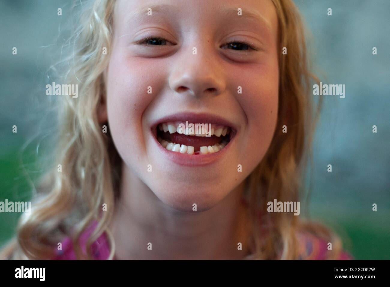 A young girl proudly shows off her mouth and the gap in her teeth where ...