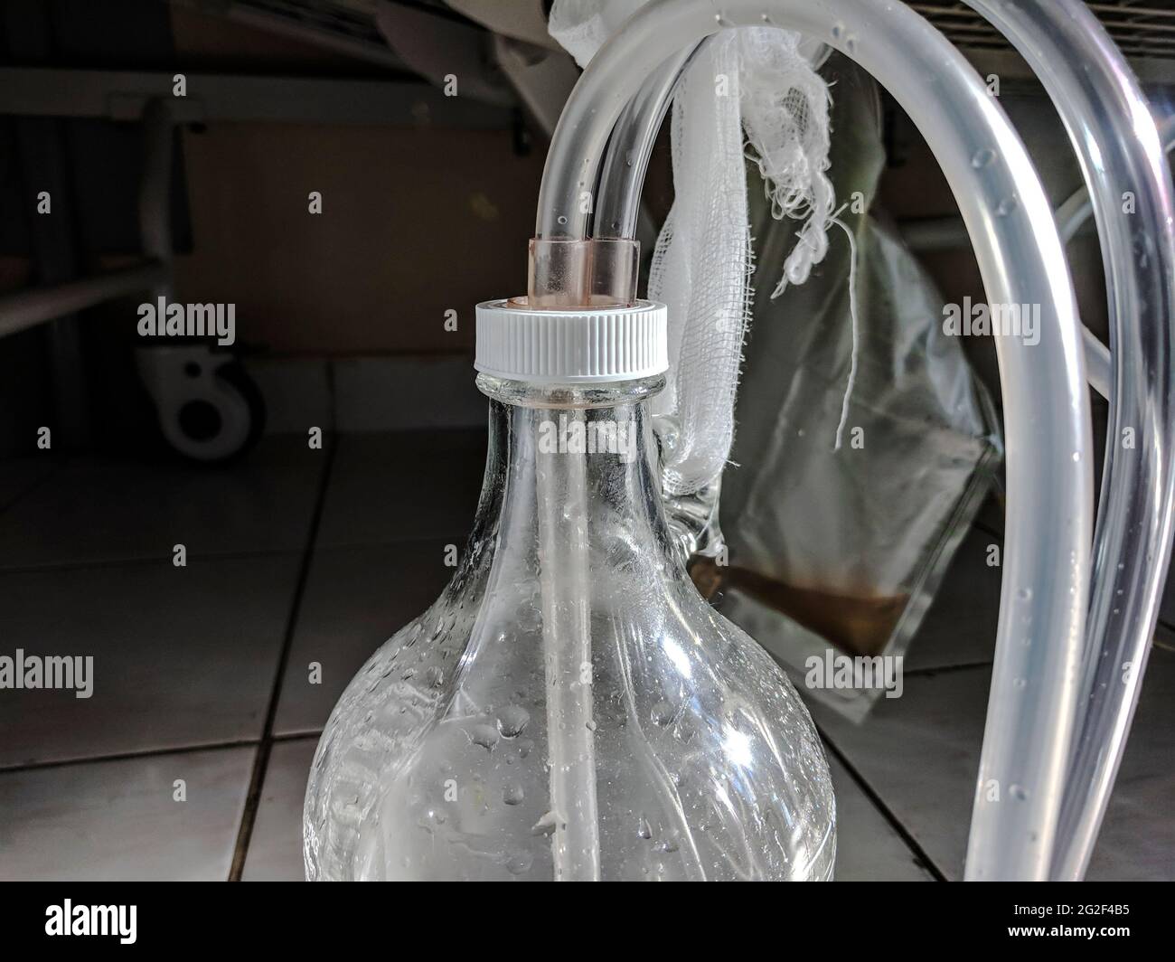 Pneumothorax Chest Drain Chest connected to a fluid-filled bottle with ...