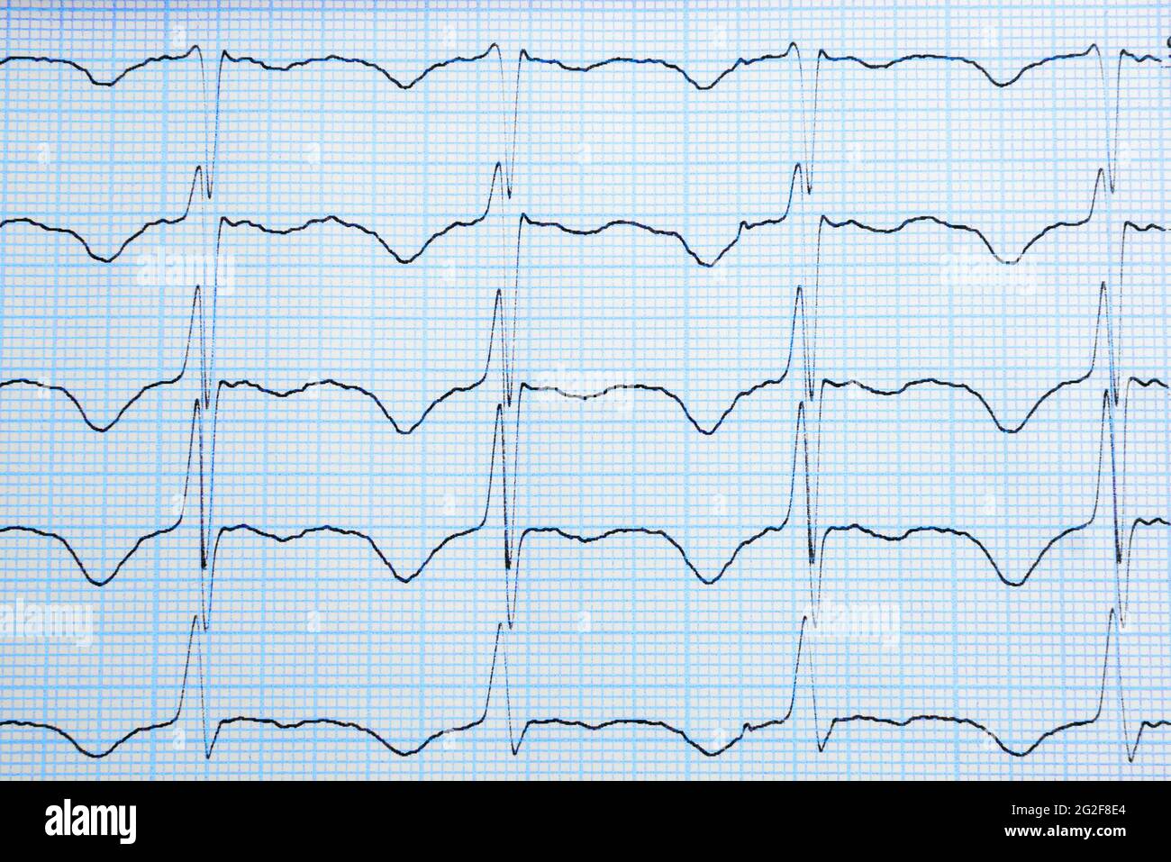 cardiogram graph paper background Stock Photo - Alamy
