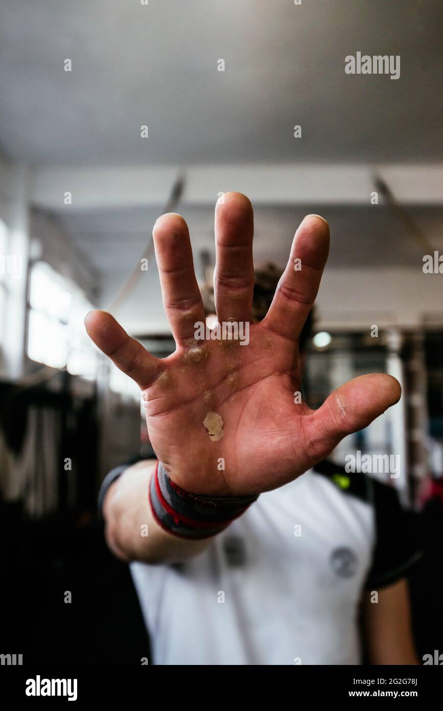 Athlete man's hand after intense training Stock Photo - Alamy