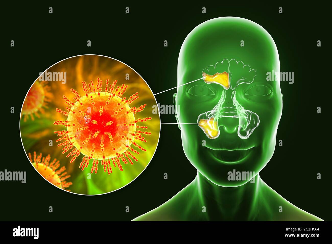 Human parainfluenza virus hi-res stock photography and images - Alamy