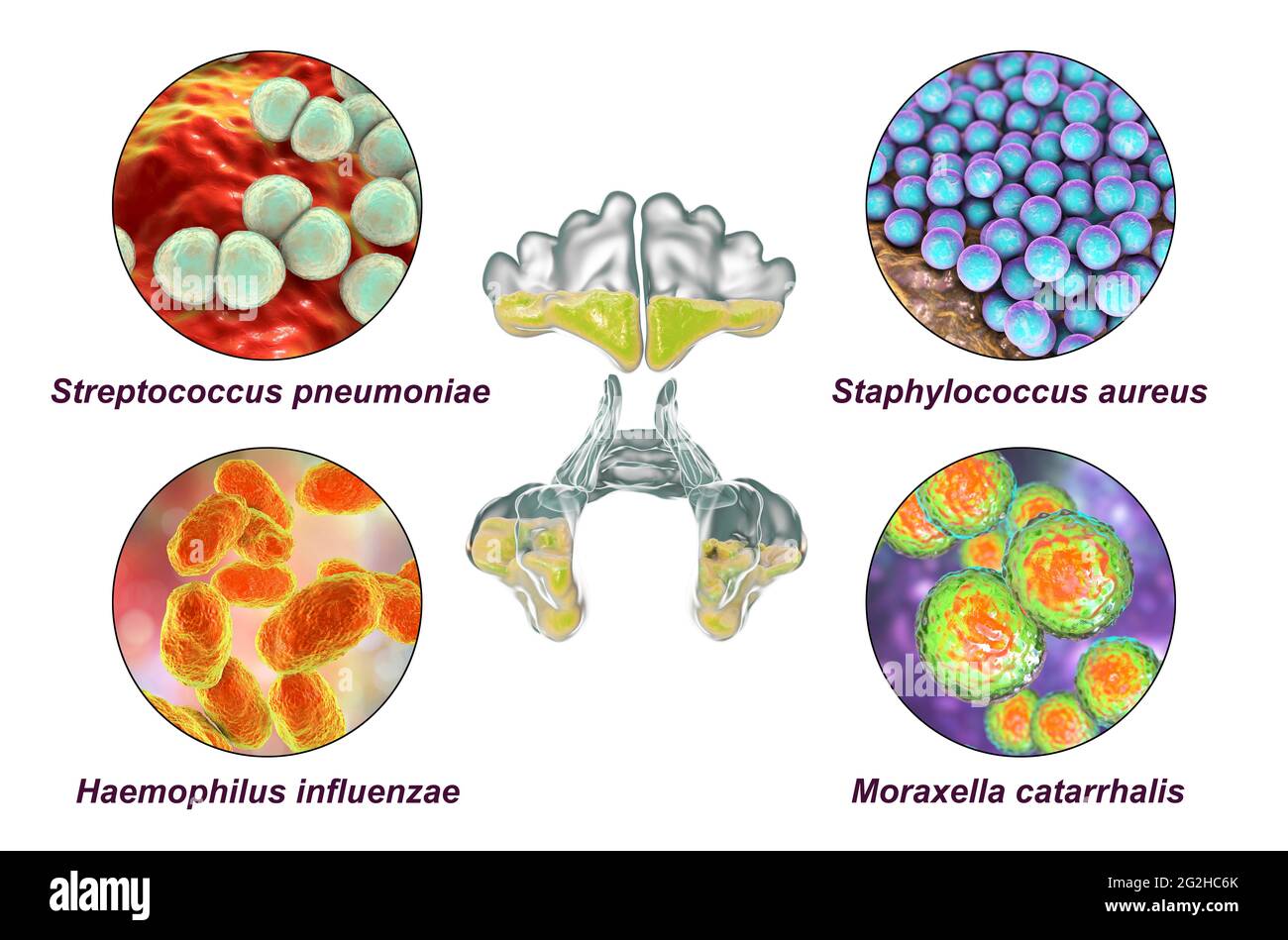 Sinuses medicine illustration Cut Out Stock Images & Pictures - Alamy