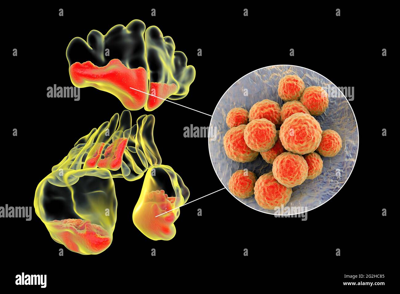 Sphenoid sinus hi-res stock photography and images - Alamy