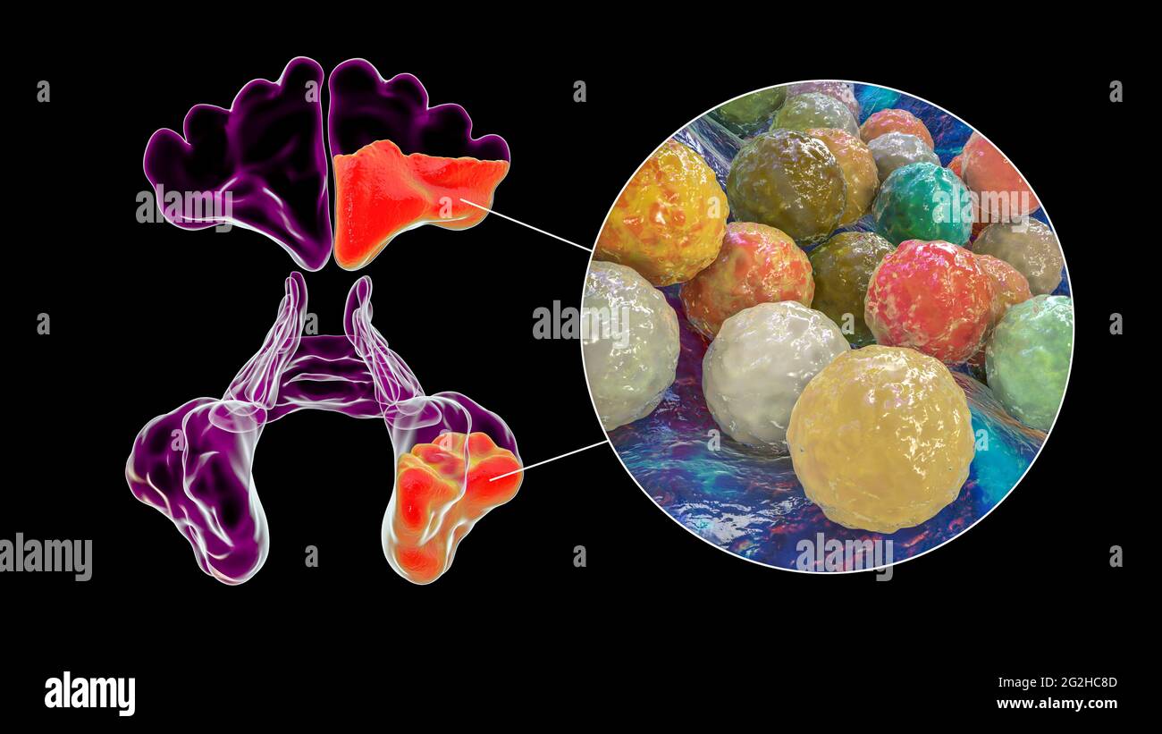 Sphenoid sinuses hi-res stock photography and images - Alamy