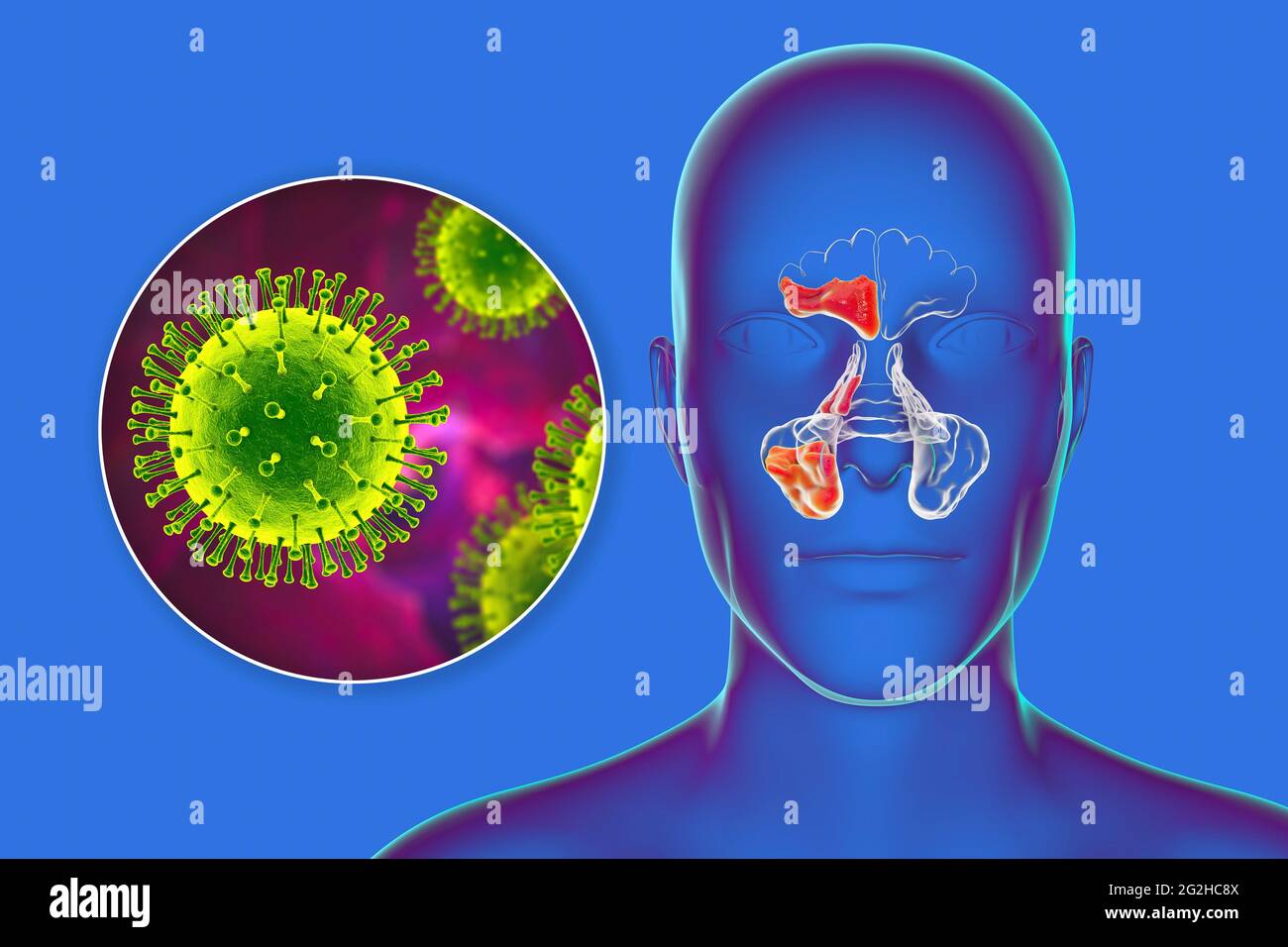 Frontal Sinus High Resolution Stock Photography and Images - Alamy