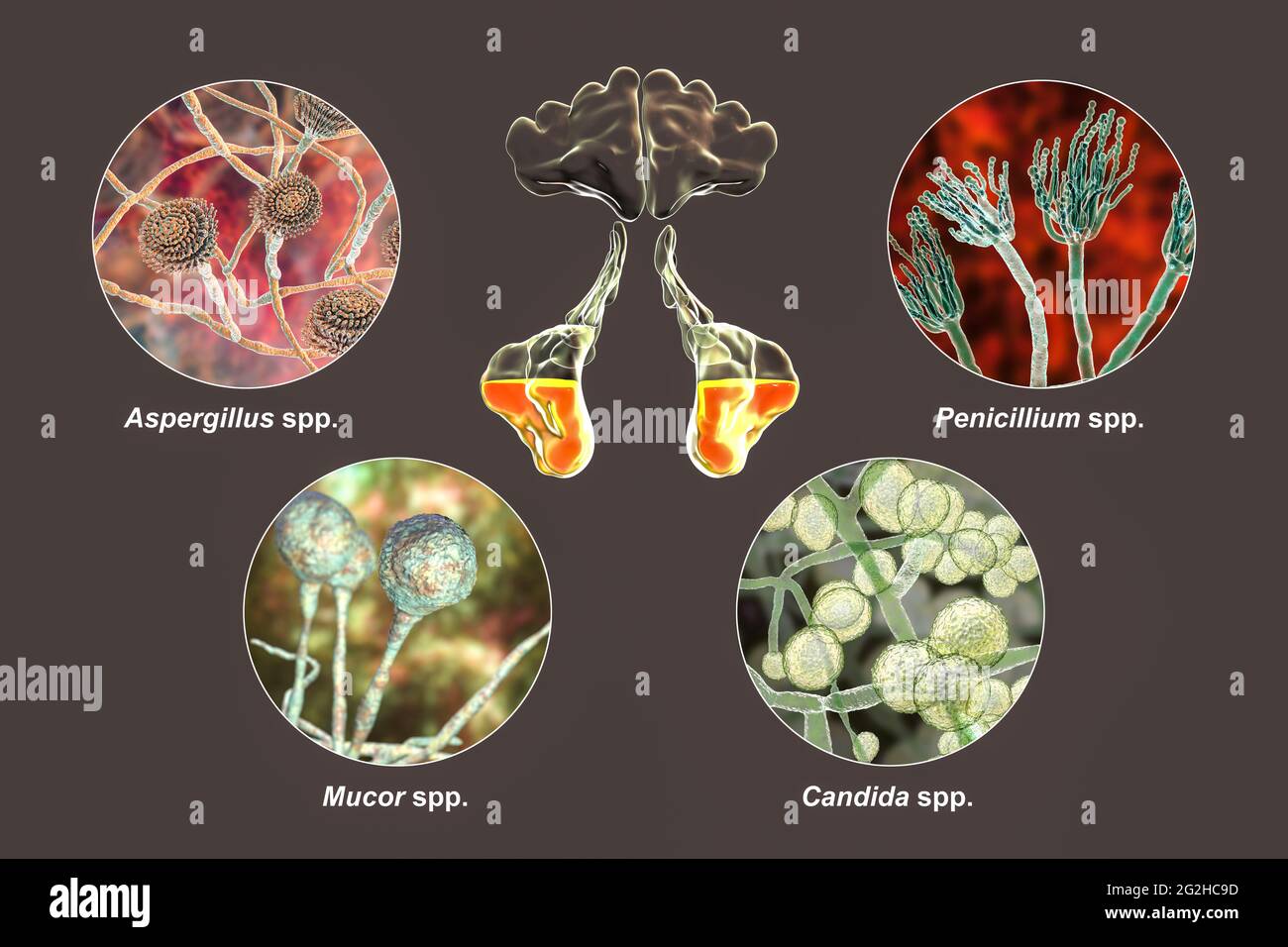 Fungal sinusitis hi-res stock photography and images - Alamy