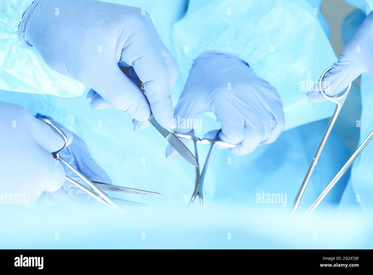 A group of surgeons is operating at the hospital, close-up of hands ...
