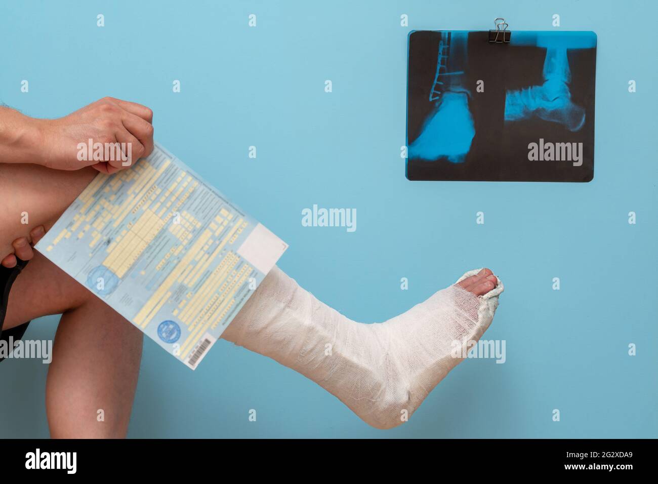 Open fracture hi-res stock photography and images - Alamy