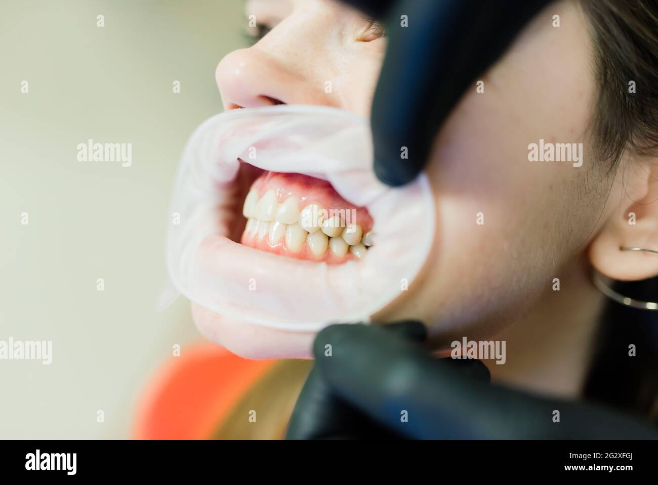 Dentist examining a patient's teeth in a dentist Stock Photo - Alamy