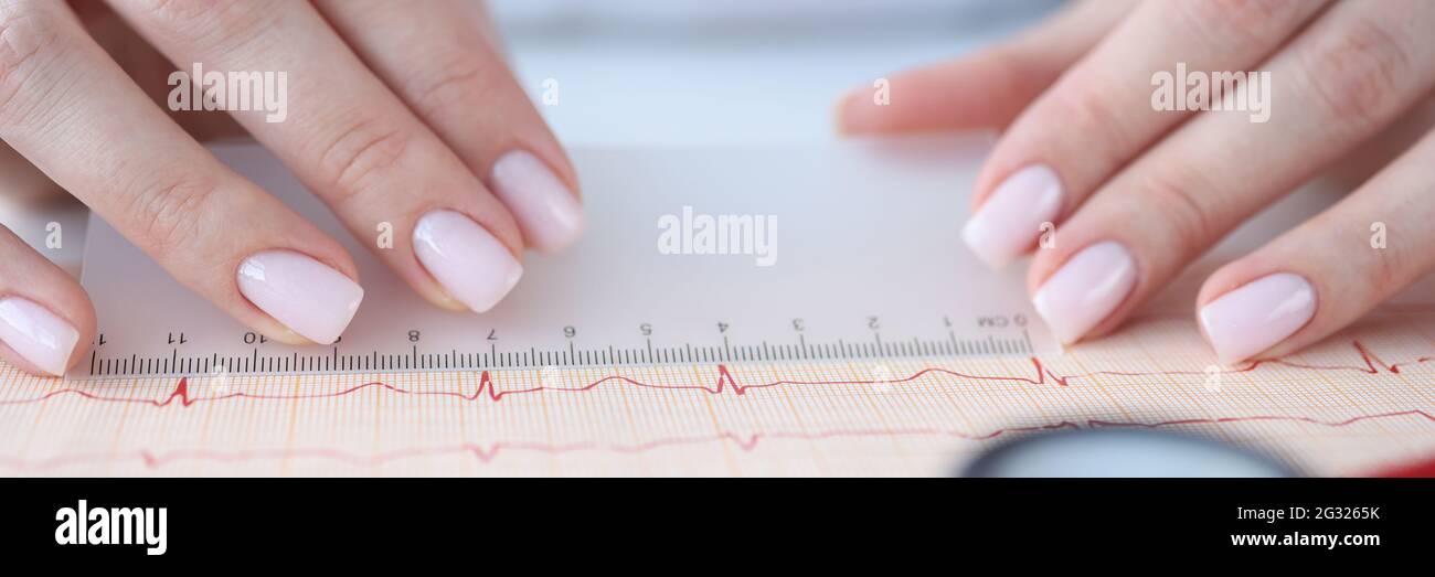 Doctor cardiologist examining electrocardiogram with ruler closeup ...