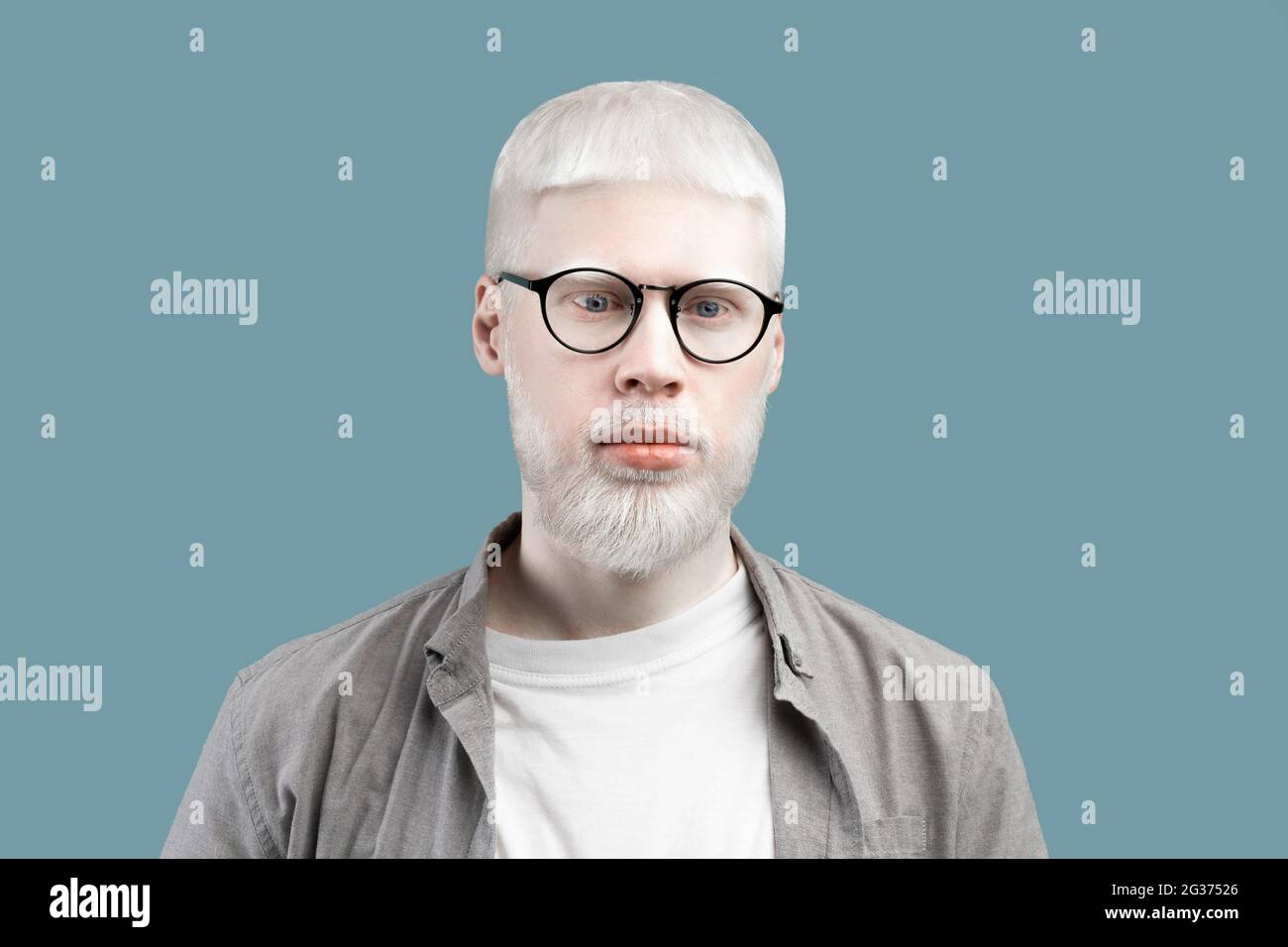 Albino Actors Male 60 Photos - Moonagedaydream.film