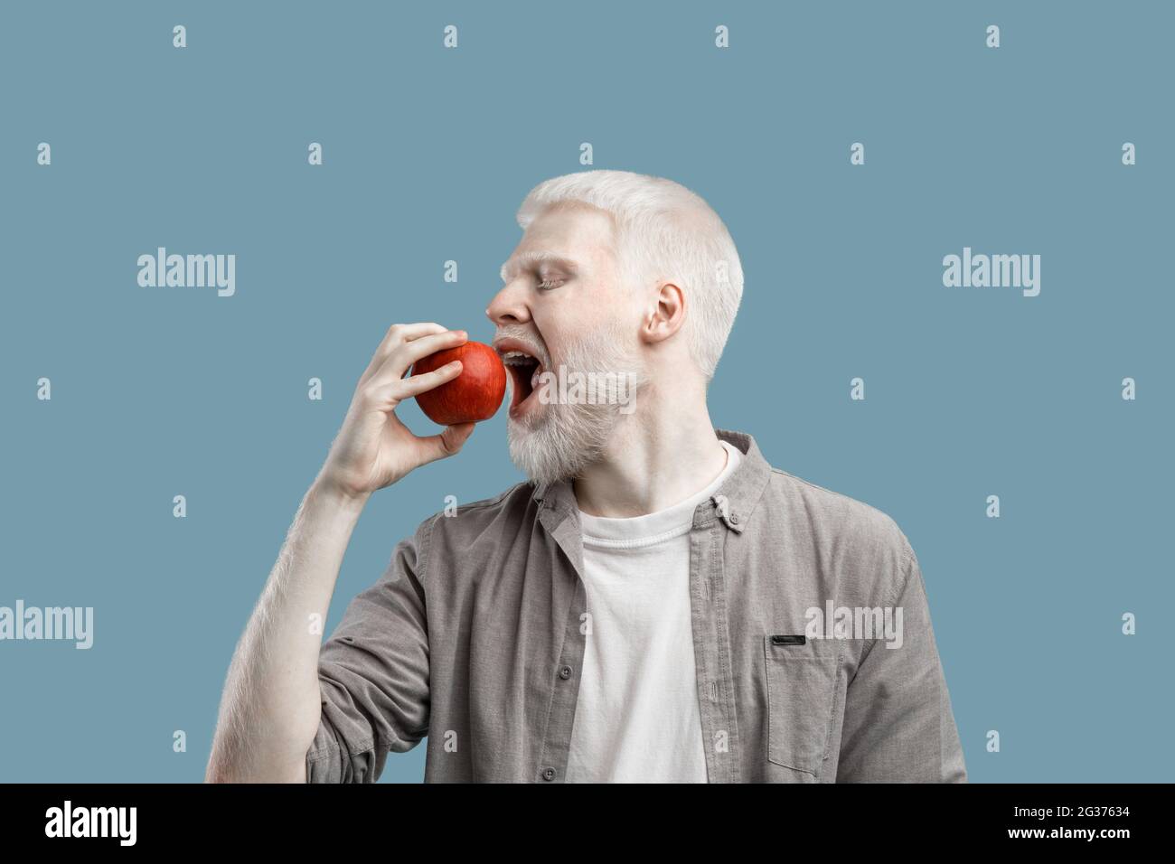 Eat fruits. Young albino man biting fresh red apple, standing over ...