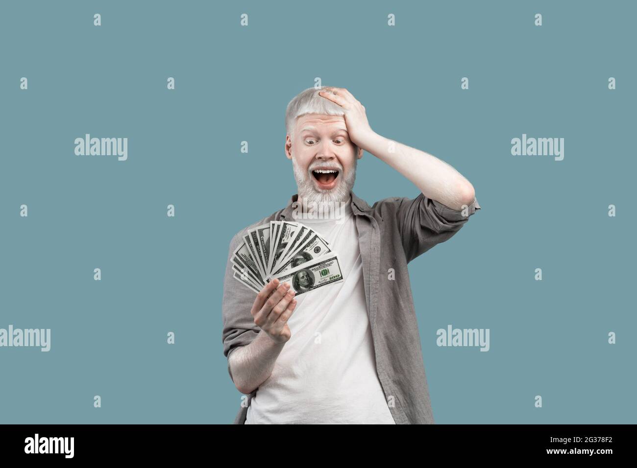 Excited extraordinary albino guy holding lots of money, touching head ...
