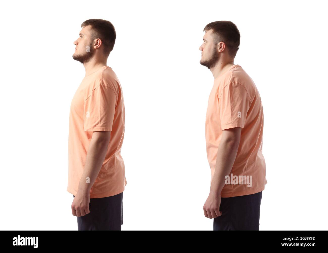 Young man with bad and proper posture on white background Stock Photo ...