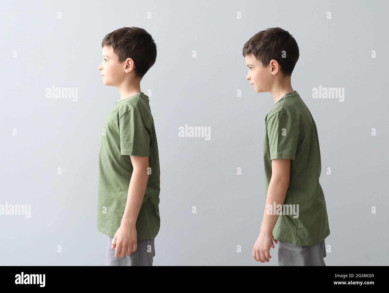 Hunched back posture hi-res stock photography and images - Alamy