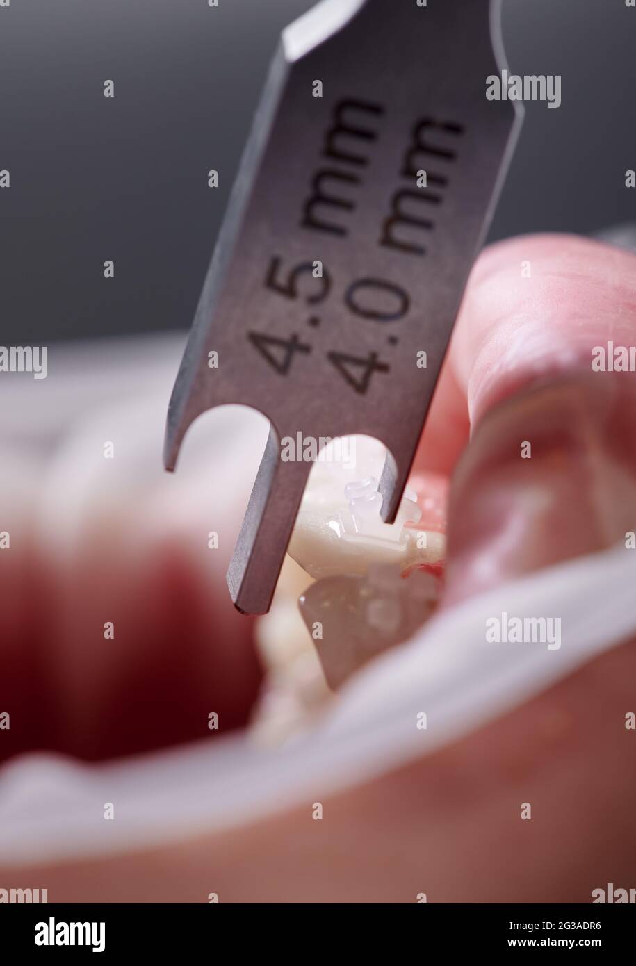 Dental height gauge. Macro photography. Vertical close-up snaphot of a ...