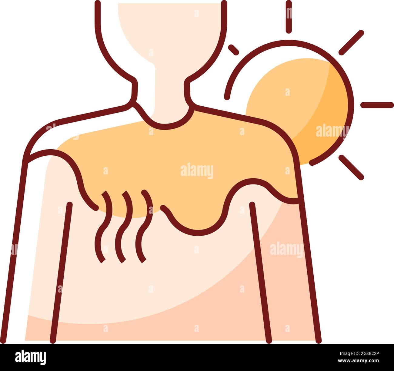 Sunburn RGB color icon Stock Vector Image & Art - Alamy