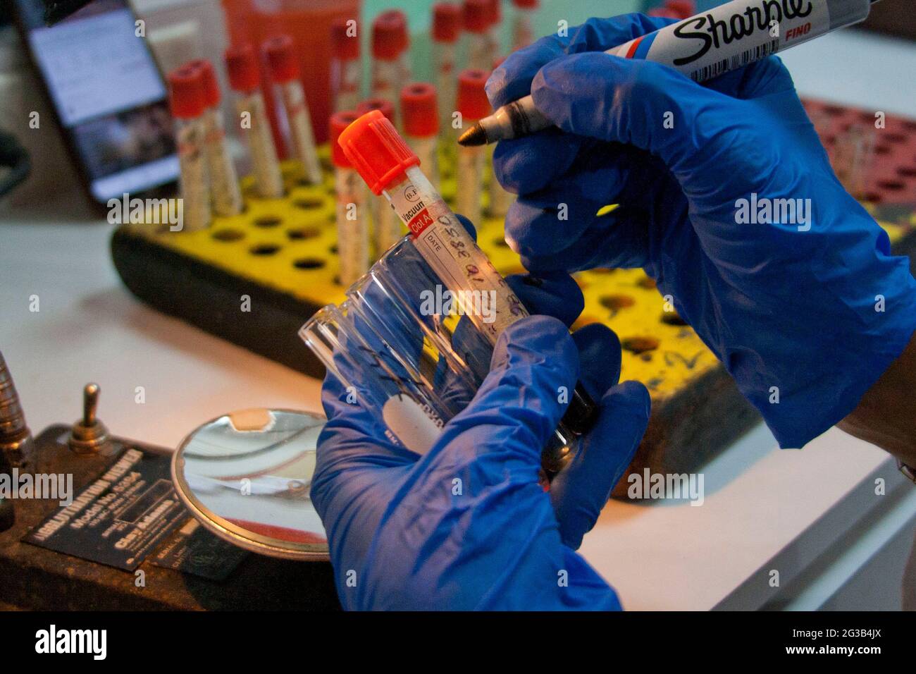 Non Exclusive: CARACAS, VENEZUELA - JUNE 14: A health worker analyzes ...