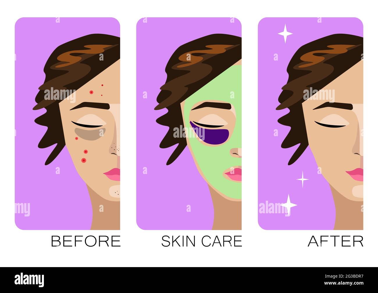 Woman acne patch Stock Vector Images - Alamy