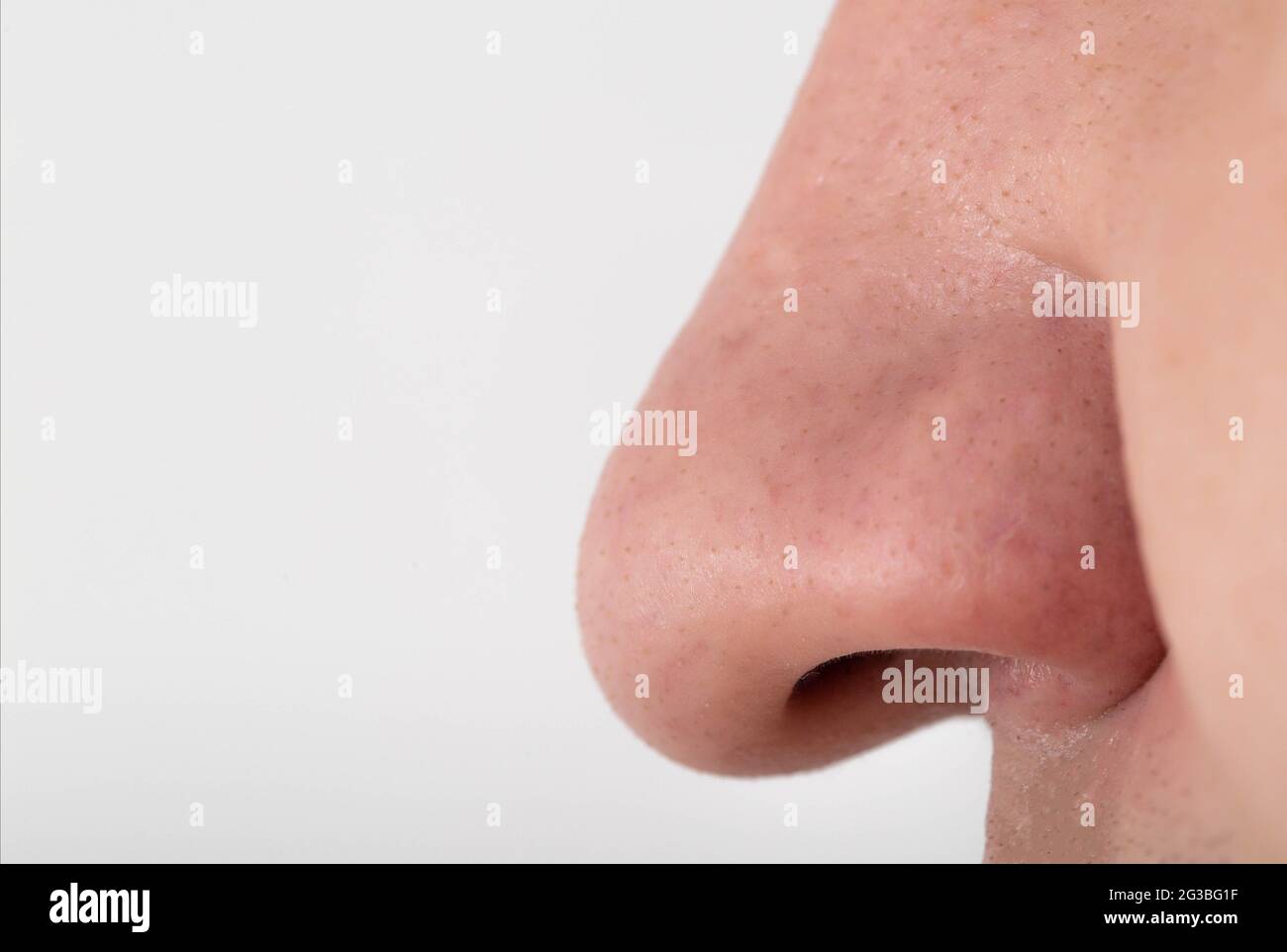 A man has a wide fleshy big nose, close-up. Nose reduction plastic ...