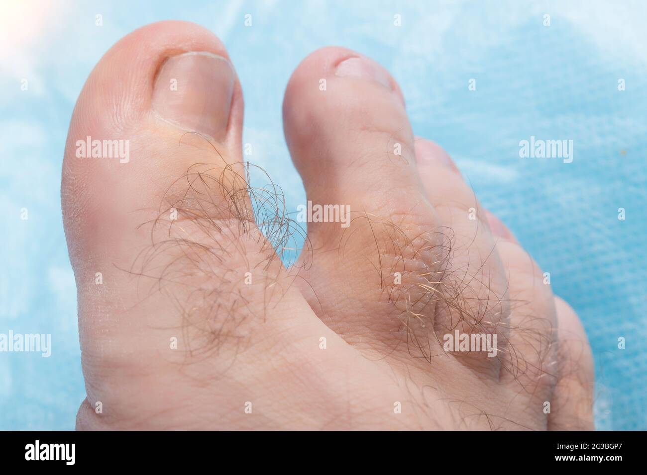 Hairiness on the toes of a person, close-up. Hygiene and cosmetology ...